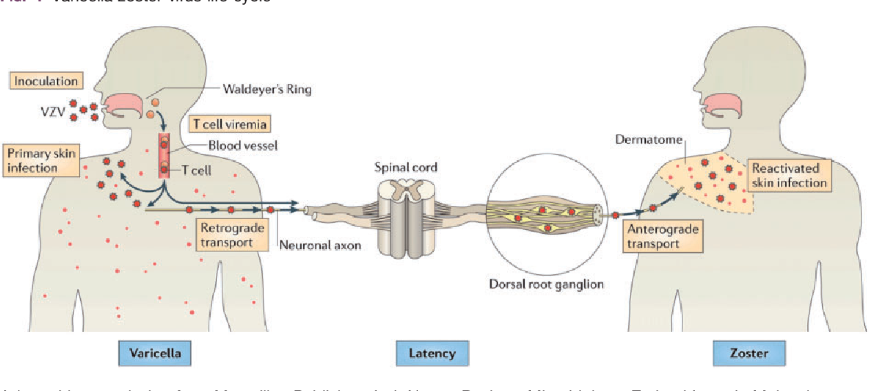 clinlab navigator - Varicella Zoster PCR