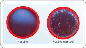 clinlab navigator - Weil Felix Reaction